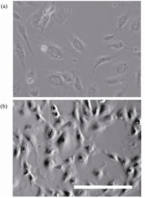 Measuring Surface Geometry Of Adherent Cells Using Oblique