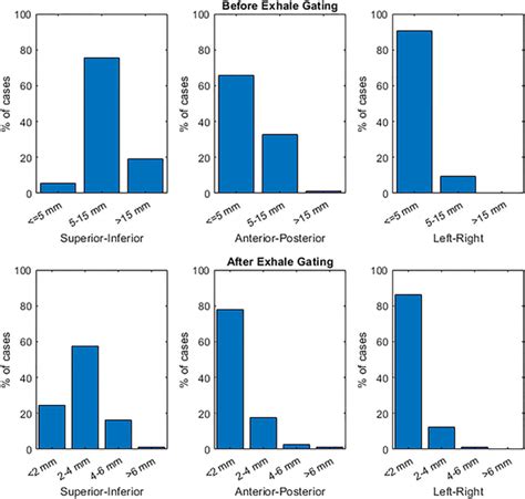 Motion Of Sbrt Treatment Targets In All Three Directions Before Gating Download Scientific