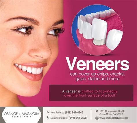 Differences Between Composite Bonding And Veneers Artofit