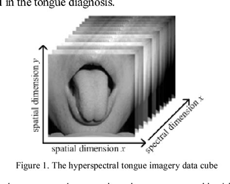Figure 1 From Hyperspectral Tongue Imaging System Used In Tongue