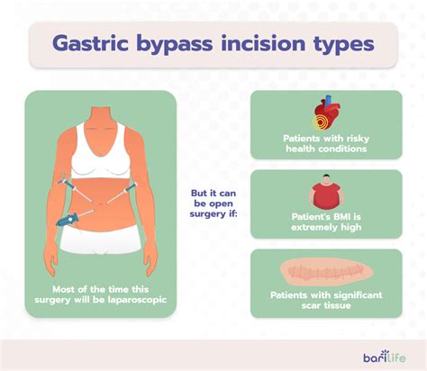 Laparoscopic Gastric Bypass Scars