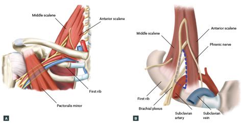 Anterior Scalene Phrenic