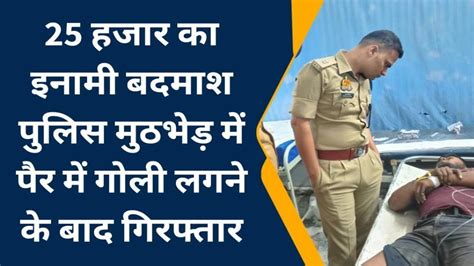 गोरखपुर पुलिस एनकाउंटर 25 हजार का इनामी गिरफ्तारपैर में लगी गोली
