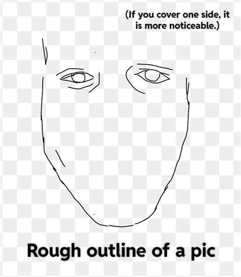 One Side Of Face Completely Undeveloped Need Help R Orthotropics