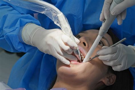 Root Canal Re Treatment 200 St Langley Dentist