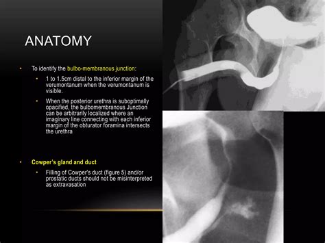 Ascending Urethrogram Pptx