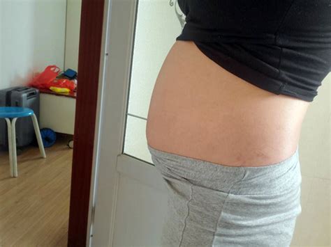 先天性无子宫有卵巢想要生孩子该怎么办呢 莱婴健康