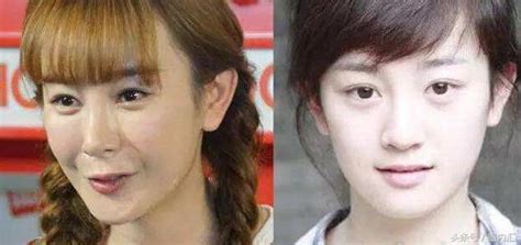整容变成毁容，张檬为什么执迷不悟 每日头条