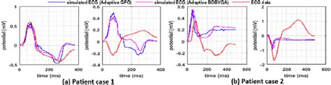 Real Data Experiments Comparison Of The Real Ecg Data And The Download Scientific Diagram