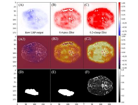 Improving Interpretability Through More Visualization Of More Relevant