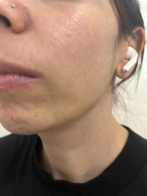 How Can I Make My Skin Look Smoother And Better Rskincareaddicts