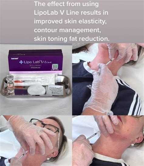 Korea Lipo Lab V Line Premium Best Way To Losing Weight Face Double