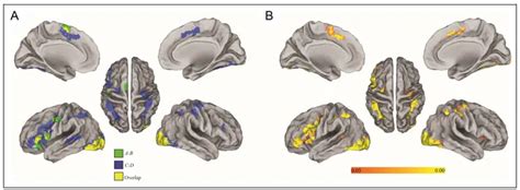 Distributed Code For Semantic Relations Predicts Neural Similarity