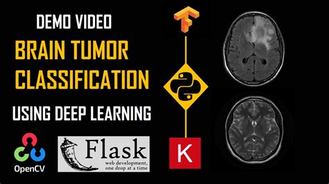 Deep Learning Project Brain Tumor Classification DEMO Keras Python