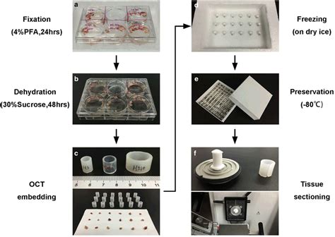 Fixation Histology Protocol At Lucas Cade Blog