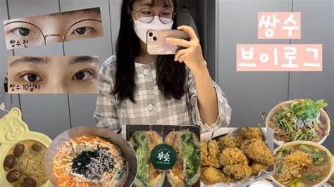 쌍수 브이로그ㅣ 절개 쌍수 눈매교정 미니앞트임ㅣ1~10일차 붓기과정ㅣ쌍수하고 출근하고 산업기사실기보고 강릉가는 일상ㅣ황금올리브치킨 월남쌈 벌집장칼국수 로제컵누들 타이완누들