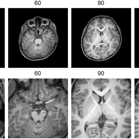 Visualization Of The Features Learned By Spatial Transformer Networks