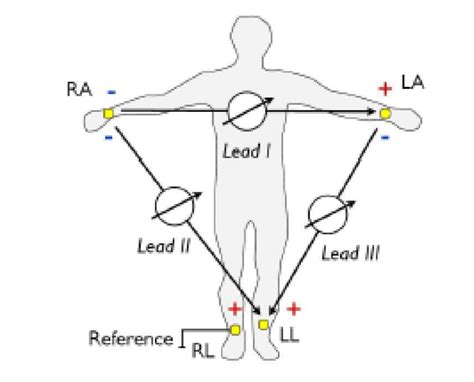 Diagram 12 Lead Ekg Limb Diagram Wiringschemacom