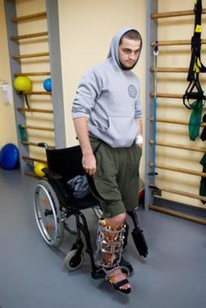 Лікарі вирощують кістку військовому після тяжкого поранення