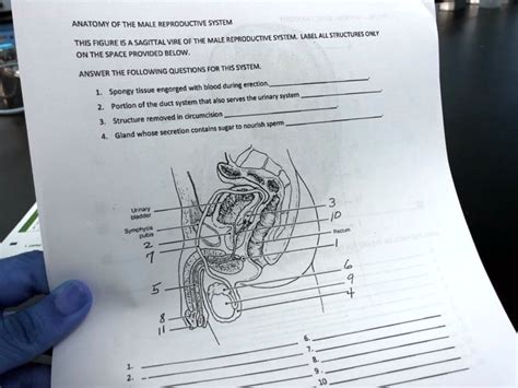 Solved Anatomy Of The Male Reproductive System On The Space Provided