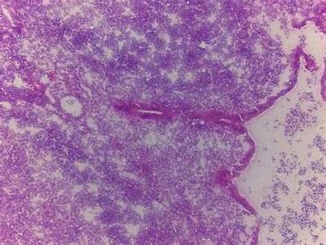 novus biologicals appendix tissue slides adult normal frozen 5