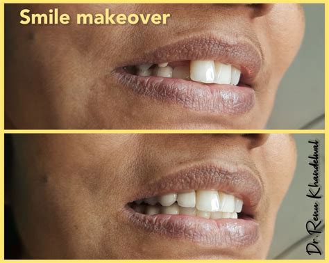 Dr Renu Khandelwal On Linkedin Dmls