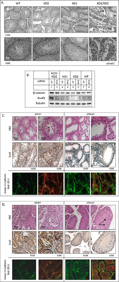 Stabilization Of Snail1 Is Responsible For The Spermatogenesis Defect