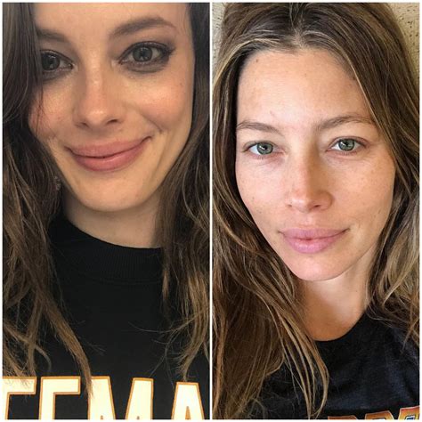 Jessica Biel Nose Job