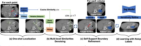 Figure 1 From One Shot Weakly Supervised Segmentation In 3d Medical Images Semantic Scholar