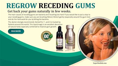 Regrow Receding Gums Naturally A Listly List