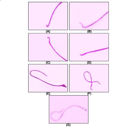 Photomicrograph Of Different Sperm Abnormalities Of Rats Fed With