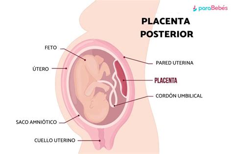 Placenta Posterior O Que Consequ Ncias E Como Evit La M Es E Filhos