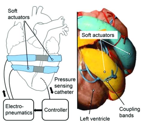 The Proposed Soft Robotic Device Control Schematic Left And In Vivo Download Scientific
