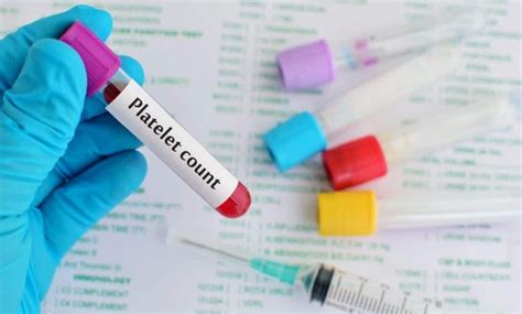 What Is Normal Platelet Count And How Does It Work Make My Health Well