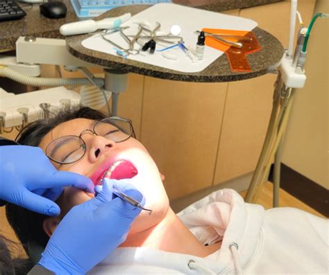 Why Is Early Orthodontic Treatment Important Fort Dental