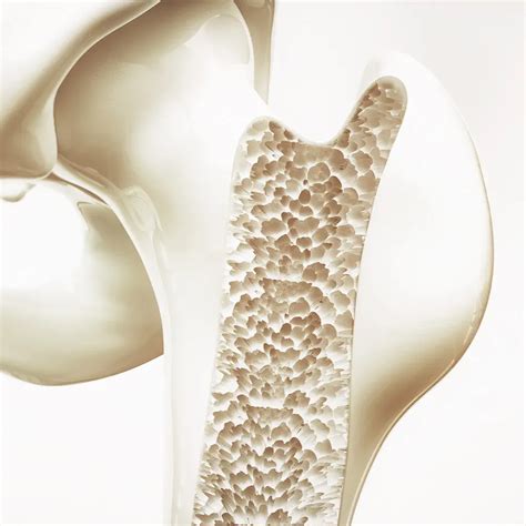 Bone Density For Winter Park Orlando And Lake Mary Fl University