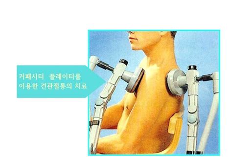 단파투열치료과정