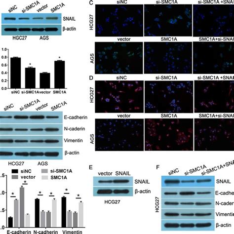 Smc1a Promoted Gc Epithelial Mesenchymal Transition Emt Via