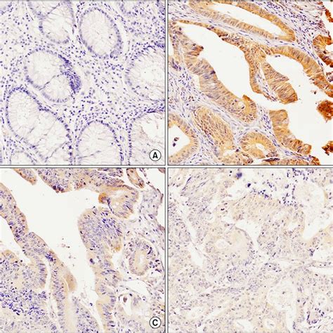 Immunohistochemical Staining For Runx3 ×400 A Runx3 Was Not