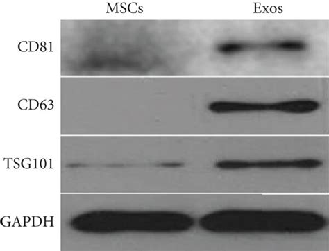 Ad Runx2 Transfection Efficiency And Exosome Characteristics A The