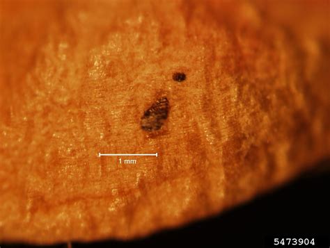 Fusarium Graminearum