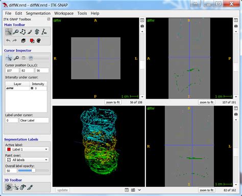 new itk snap features improve segmentation