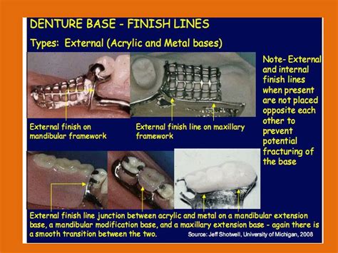1659908partial Denture Classification Ppt