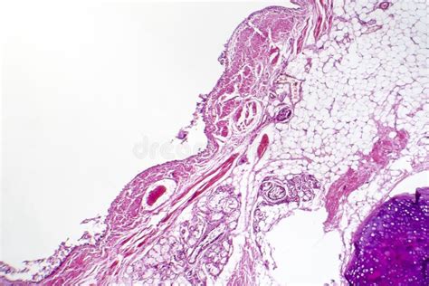 Chronic Bronchitis Under Microscope Stock Image Image Of Microscopy