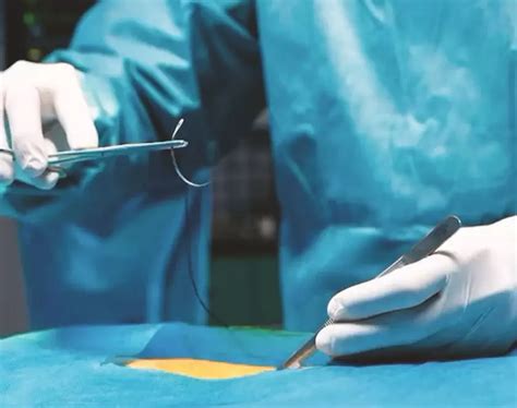 Shangring Circumcision Procedure In Surat Elegance Clinic