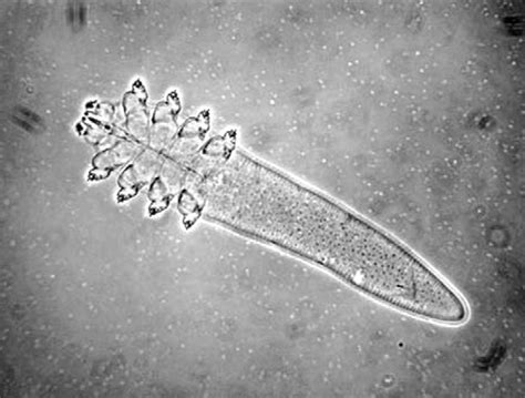 Demodex Folliculorum Under Light Microscope X100 Magnification