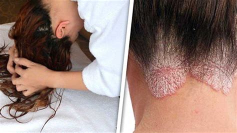 Es Malo Dormir Con El Pelo Mojado Verificar 7 Enfermedades