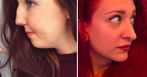 People Are Sharing Side Profile Selfies To Prove That All Noses Are