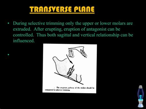 Activator And Its Modifications PPTX