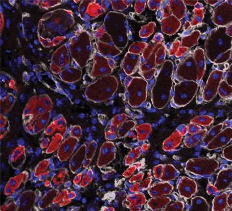 Scientists Manipulate Satellite Cells To Speed Healing UGA Today
